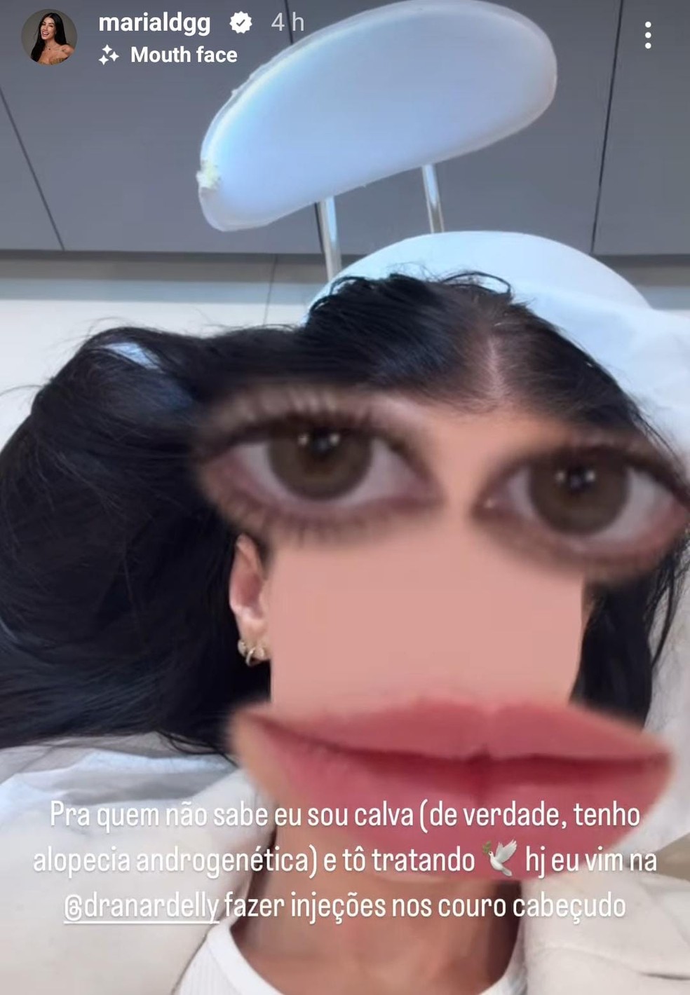 Maria Lina faz laser, retoca boca e trata alopecia em clínica: 'Sou ...