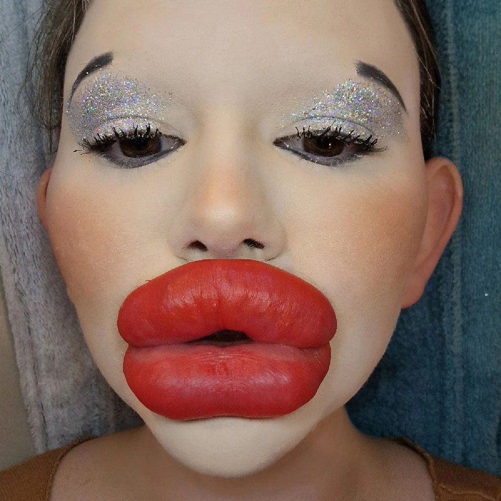 Influencer com 'maiores lábios do mundo' quer quebrar novo recorde ...