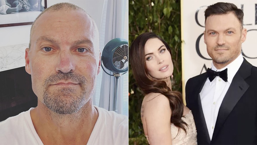 Ex de Megan Fox passou 4 anos se recuperando de doença causada por dieta