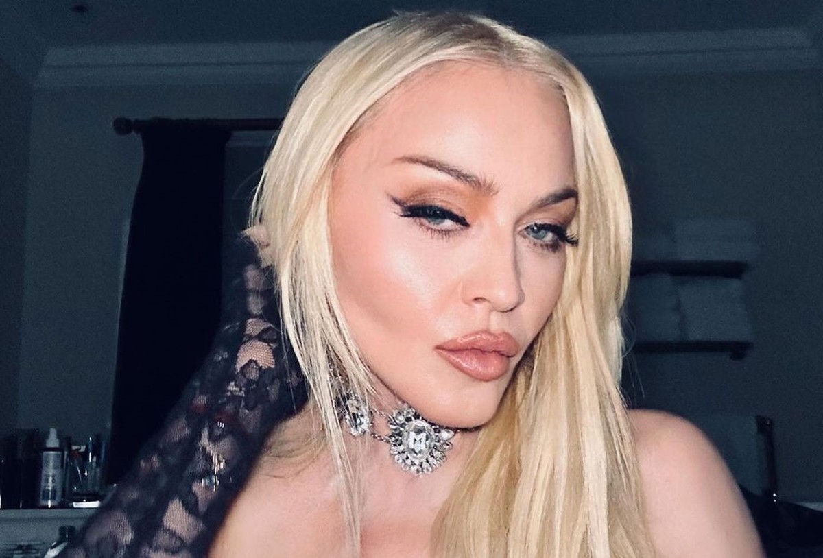 Médico dermatologista explica se é recomendado não pegar sol de jeito nenhum, como a Madonna