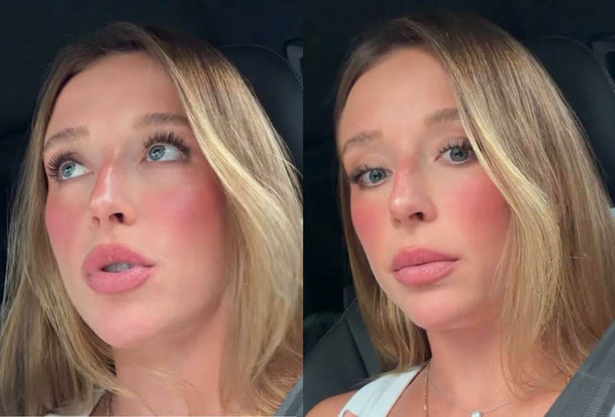 Duda Reis desabafa sobre queda de cabelo após procedimentos estéticos e ...