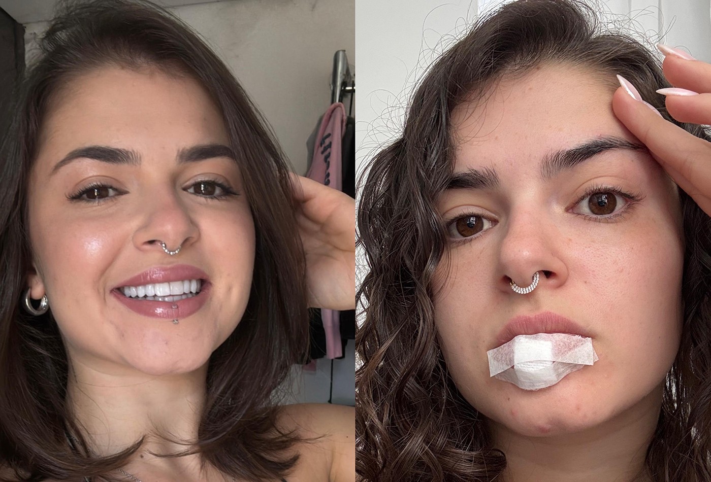 Miss Bumbum 2025 sofre acidente durante sexo por causa de piercing ...