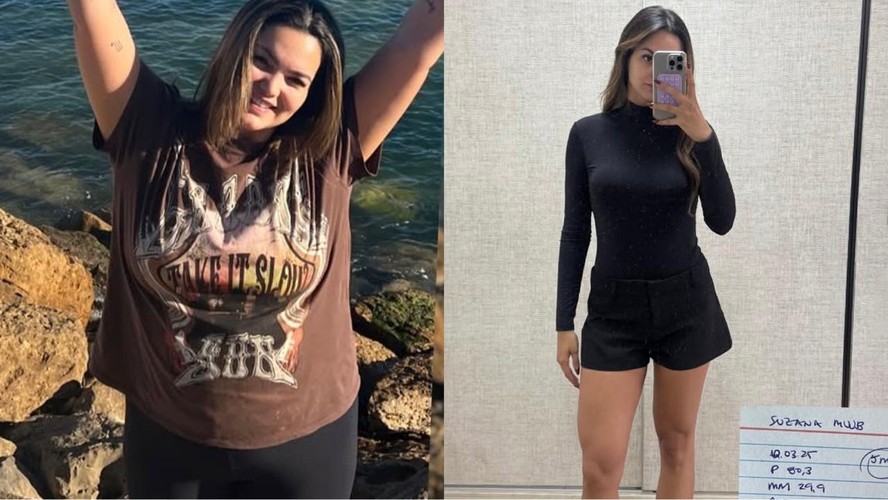 Suzanna Freitas mostra antes e depois de emagrecer 26kg e assume uso de ...