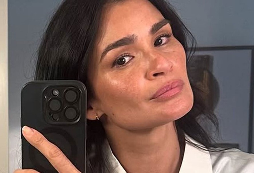 Esclerose Múltipla: o que é a doença diagnosticada em Carol Ribeiro ...