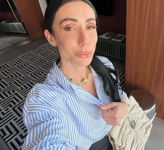 Michelle Barros: 'Sofri ao exagerar nos preenchimentos'